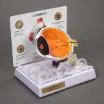 Eye Models Archives - Gulden Ophthalmics