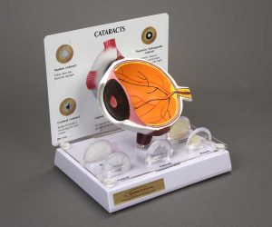 Cataract Eye Model - Gulden Ophthalmics