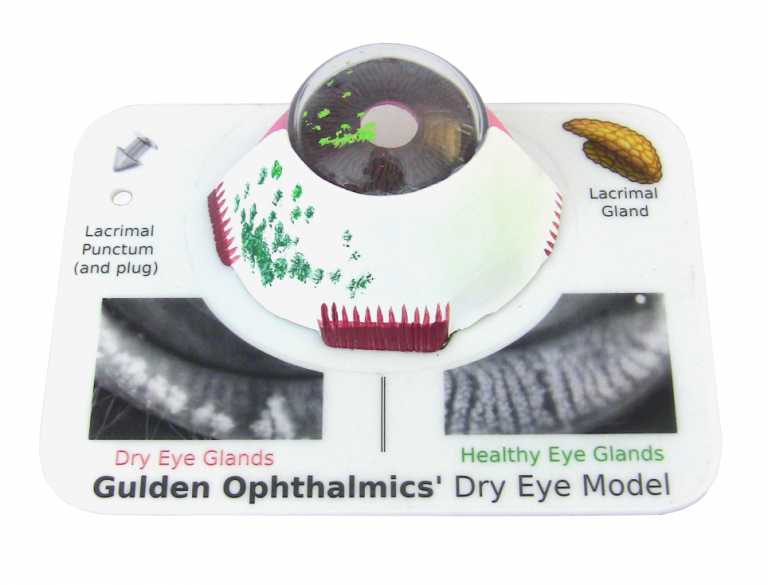 Dry Eye Model